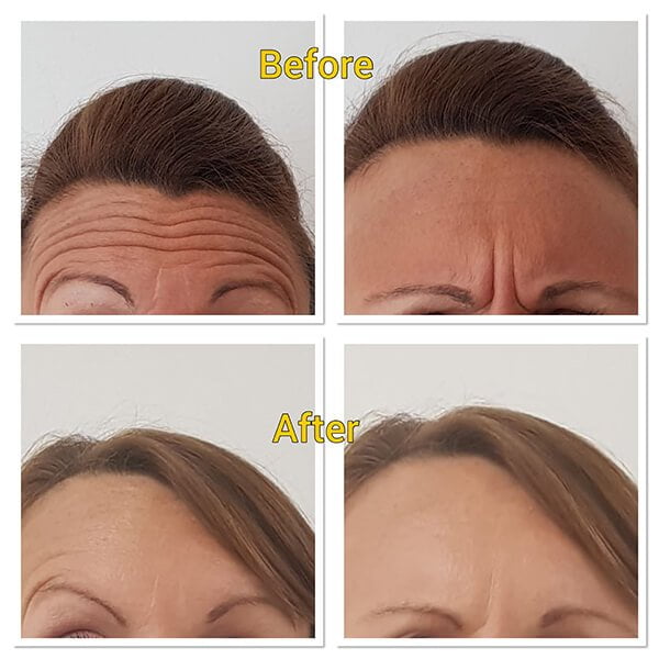 Facial Aesthetics - Wallisdown Dental Practice